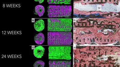 Materials & Manufacturing |Technical Briefs, Medical Design Engineering ...